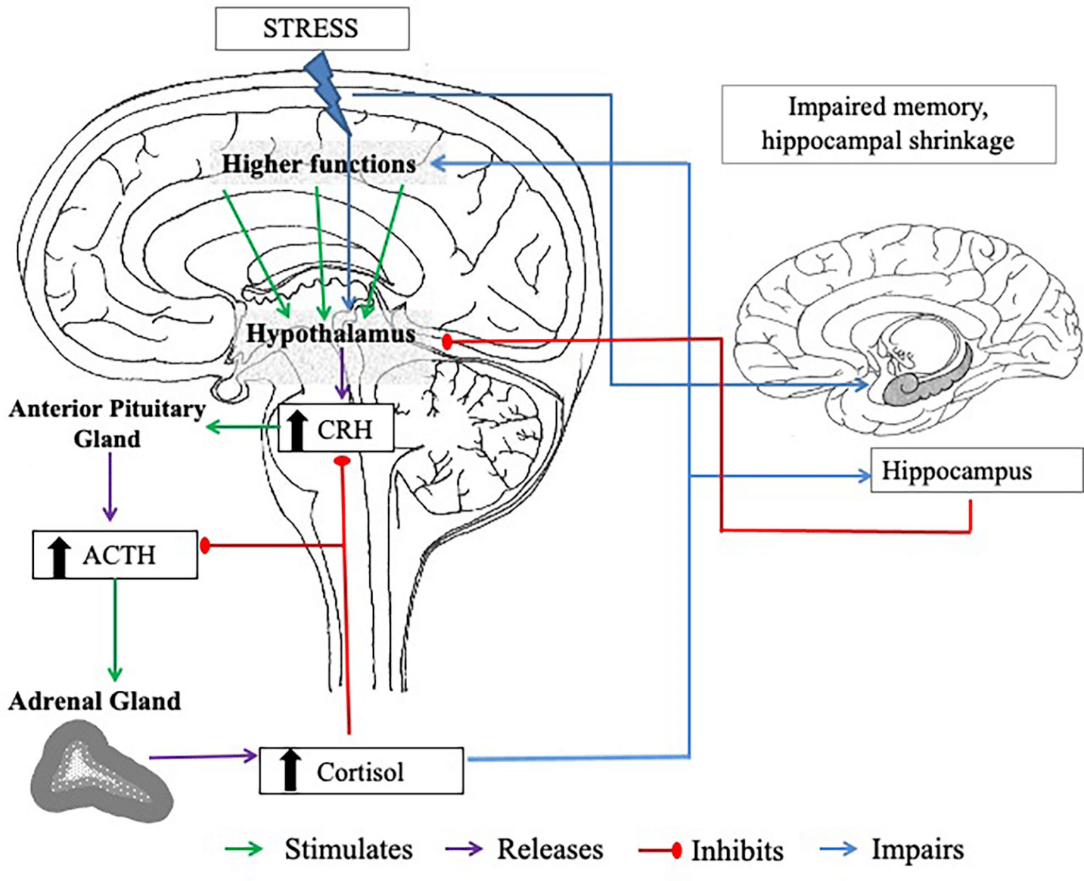 Can Anxiety Affect Your Memory A Mission For Michael
